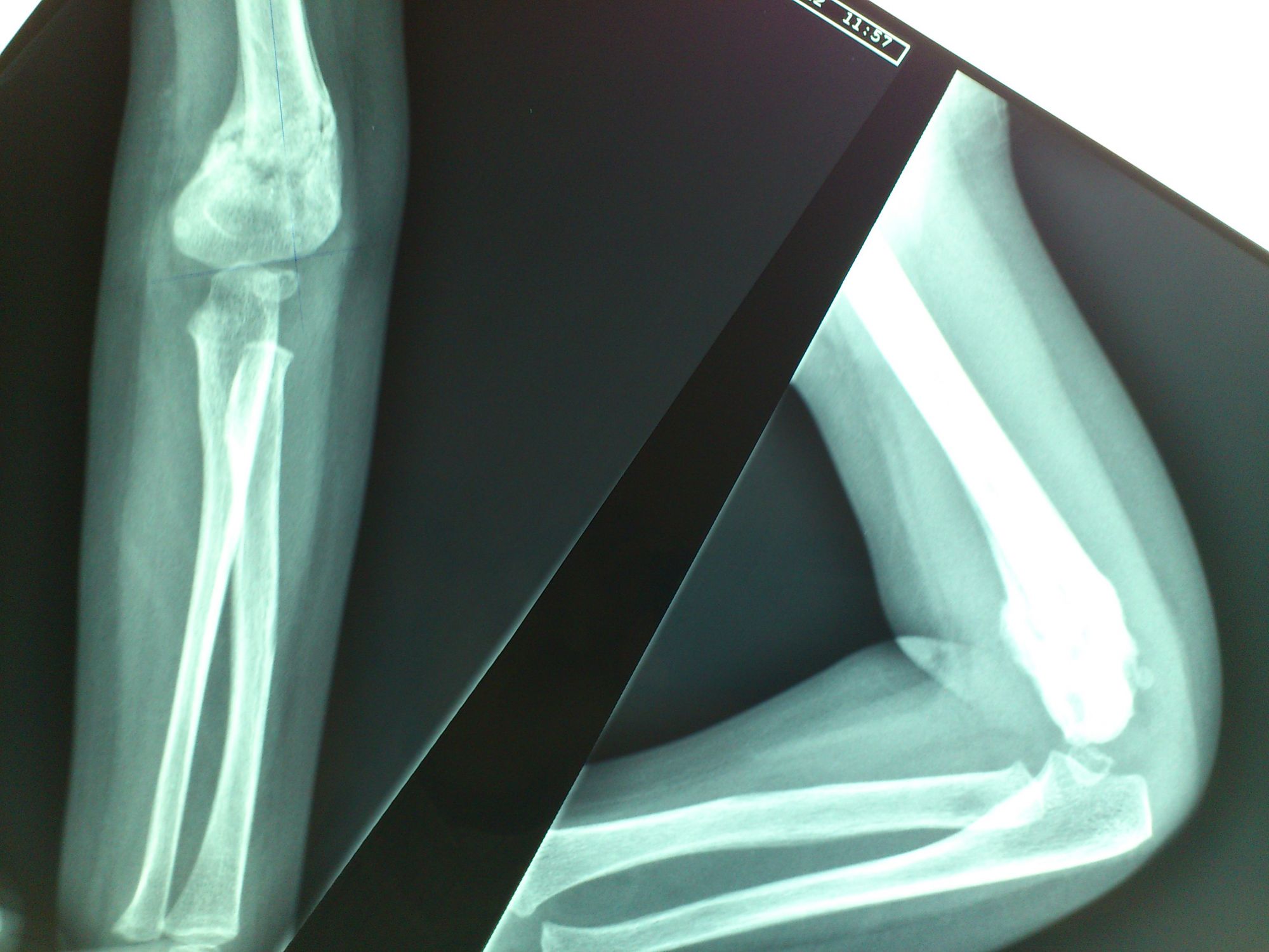 ΟΡΘΟΠΑΙΔΙΚΟΙ – ΧΕΙΡΟΥΡΓΟΙ - ΒΕΡΥΚΟΚΑΚΗΣΦΩΤΟΓΡΑΦΙΕΣ